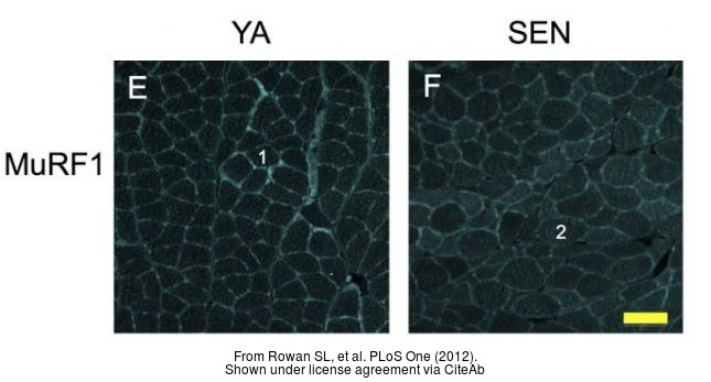 MURF1抗体 (GTX24125) | GeneTex中国官方网站