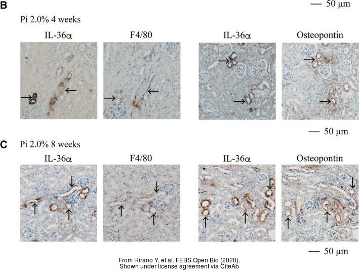 F4/80抗体 [CI:A3-1] (GTX26640) | GeneTex中国官方网站