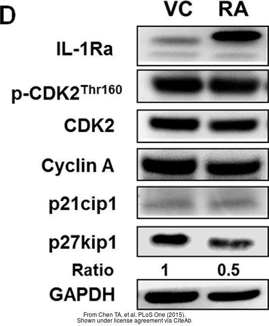 Cyclin A抗体 (GTX27956) | GeneTex中国官方网站