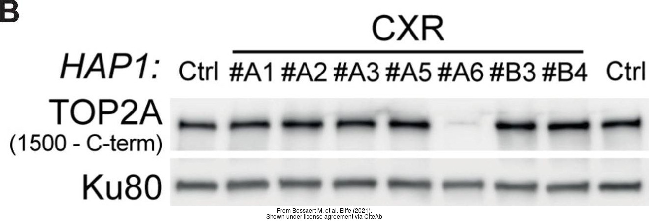 Topoisomerase II alpha抗体 [TOP2A/1361] (GTX35137) | GeneTex中国官方网站