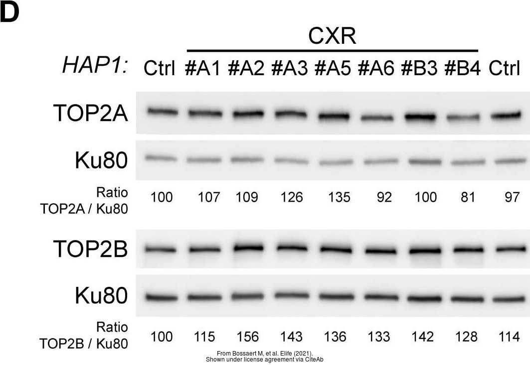 Topoisomerase II alpha抗体 [TOP2A/1361] (GTX35137) | GeneTex中国官方网站