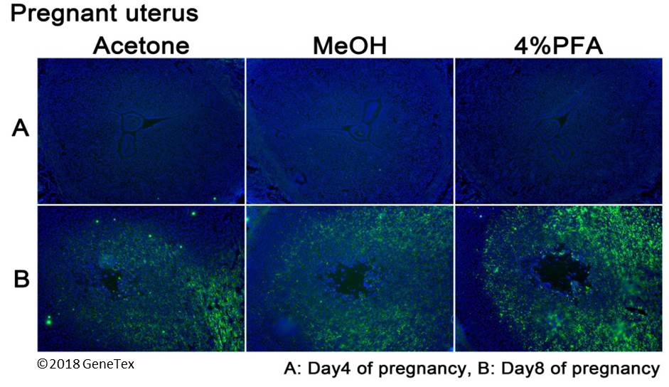 HOXA10抗体 (GTX37412) | GeneTex中国官方网站