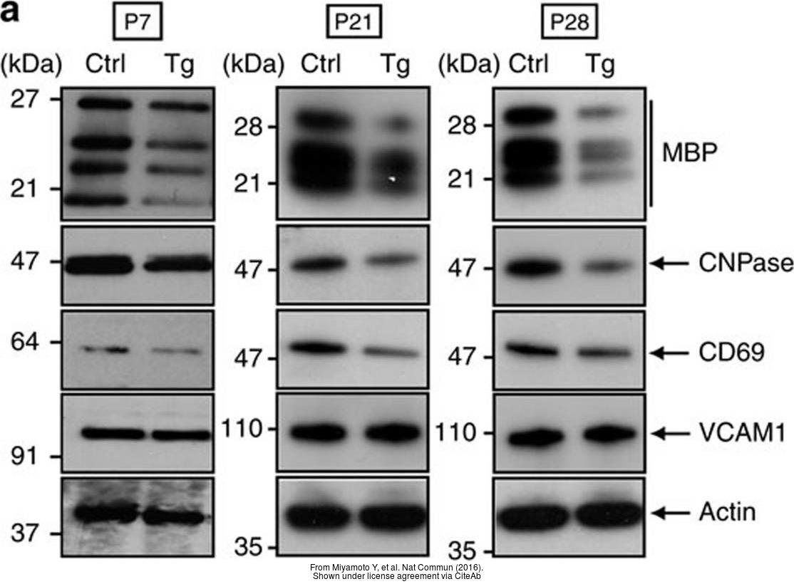 CD69抗体 (GTX37447) | GeneTex中国官方网站