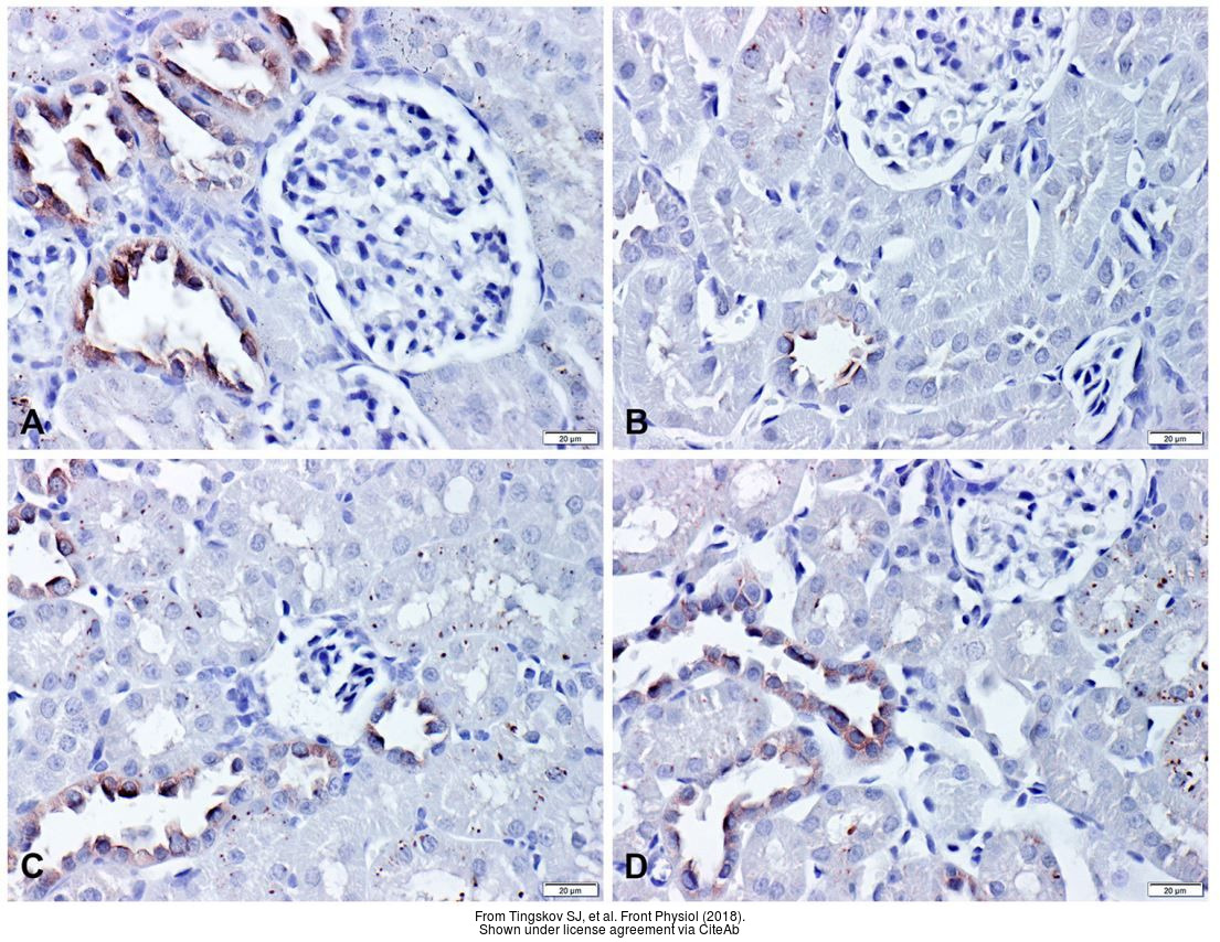 ENaC Beta抗体 (GTX41971) | GeneTex中国官方网站