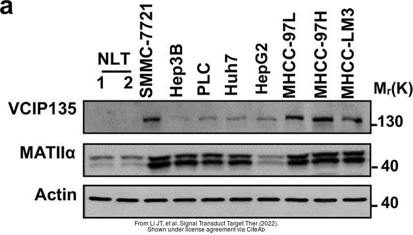 MAT2A抗体 [AT3A2] (GTX50027) | GeneTex中国官方网站