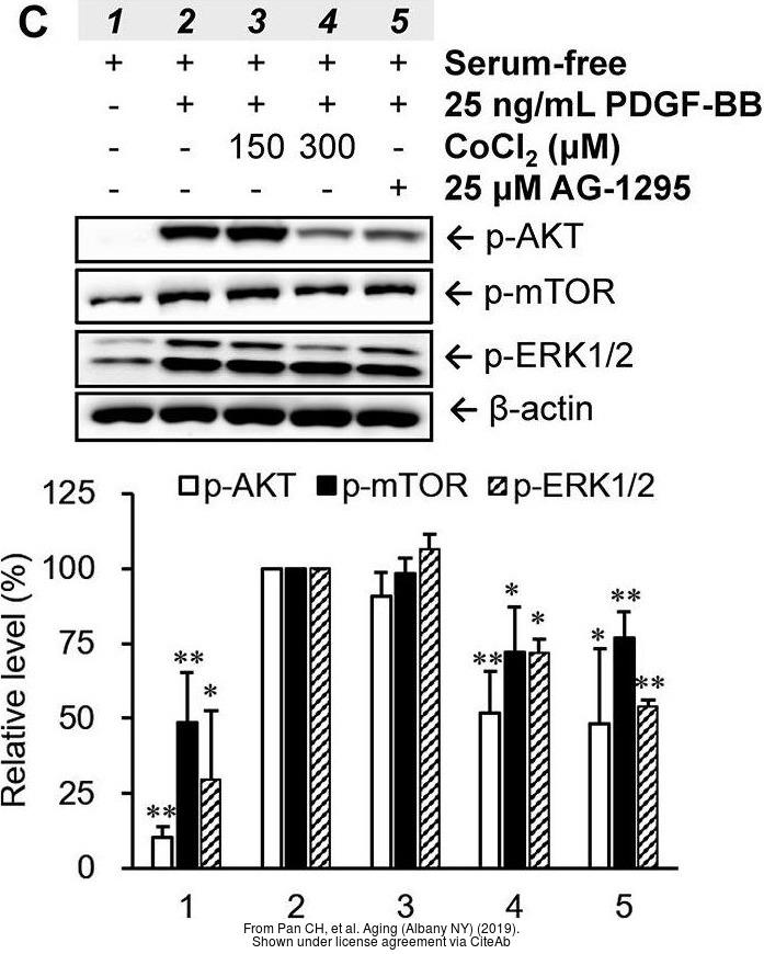 AKT (phospho Ser473)抗体 (GTX50128) | GeneTex中国官方网站