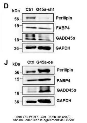 GADD45A抗体 (GTX54090) | GeneTex中国官方网站