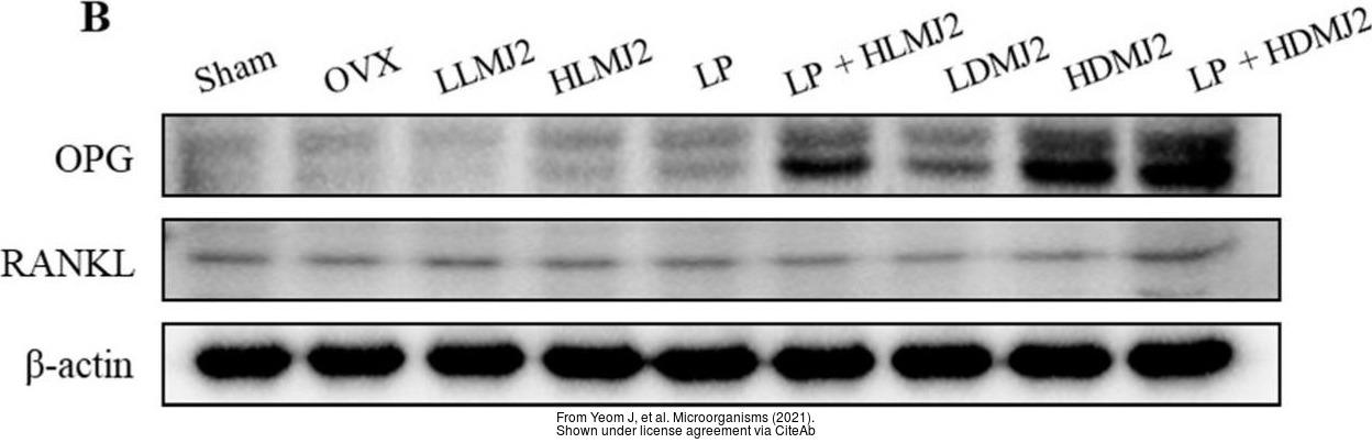 OPG抗体 (GTX55734) | GeneTex中国官方网站