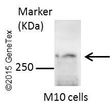 TET1抗体 [GT465] (GTX629974) | GeneTex中文官方网站