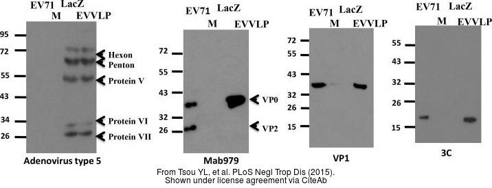 Enterovirus 71 3C抗体 [B3] (GTX630191) | GeneTex中国官方网站