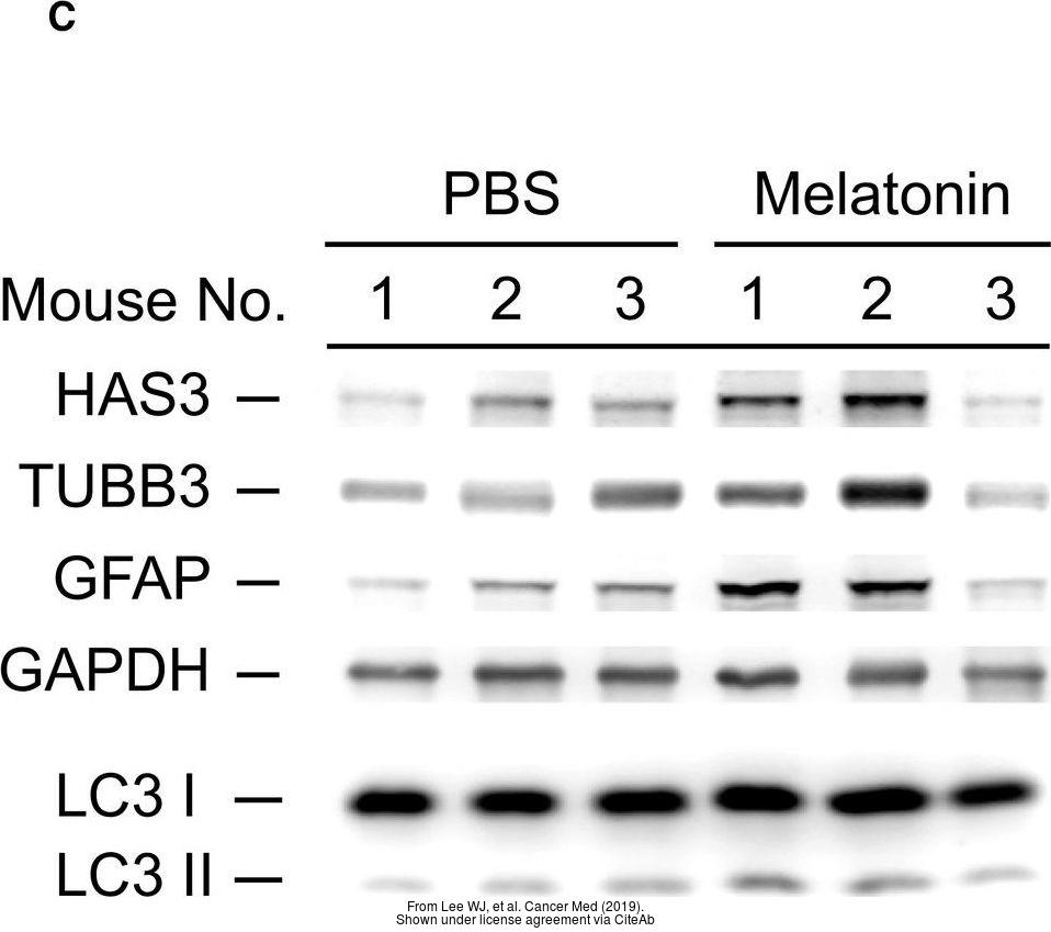 beta Tubulin 3/ Tuj1抗体 [GT11710] (GTX631836) | GeneTex中国官方网站