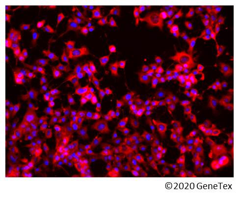beta Tubulin 3/ Tuj1抗体 [GT11710] (GTX631836) | GeneTex中国官方网站