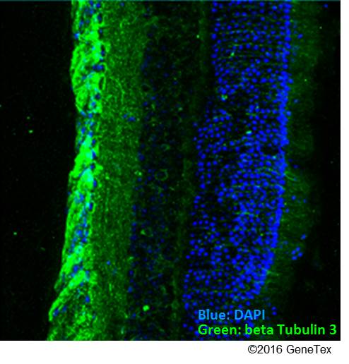 beta Tubulin 3/ Tuj1抗体 [GT11710] (GTX631836) | GeneTex中国官方网站