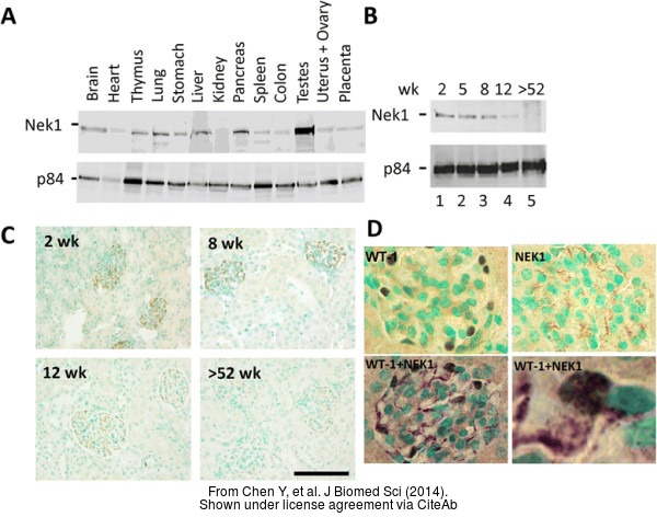 Nuclear Matrix Protein p84抗体 [5E10] (GTX70220) | GeneTex中国官方网站