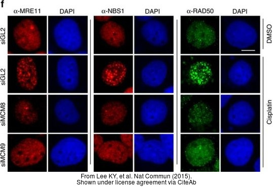 Rad50抗体 [13B3] (GTX70228) | GeneTex中国官方网站