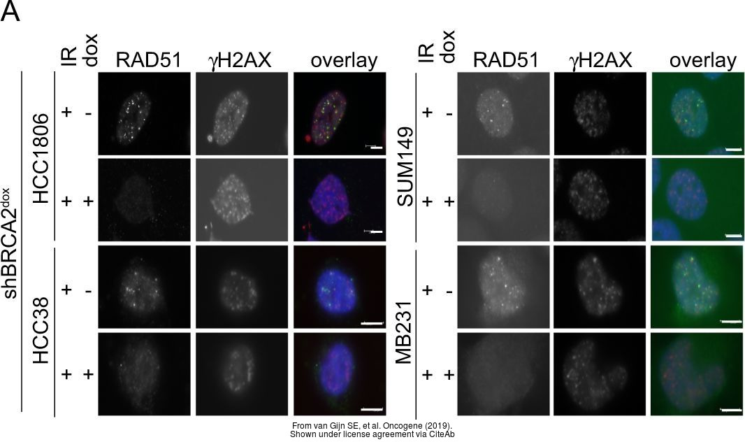 Rad51抗体 [14B4] (GTX70230) | GeneTex中国官方网站