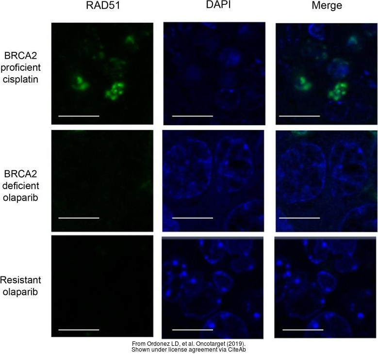 Rad51抗体 [14B4] (GTX70230) | GeneTex中国官方网站