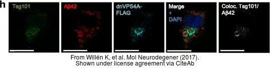 TSG101抗体 [4A10] (GTX70255) | GeneTex中国官方网站