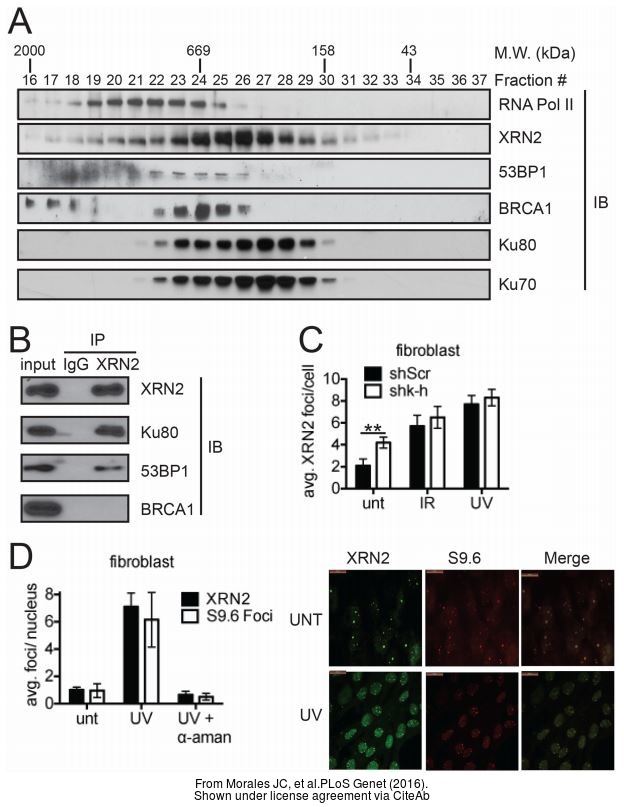 Ku80抗体 (GTX70485) | GeneTex中国官方网站