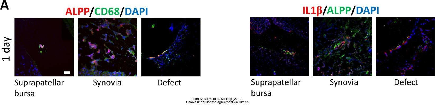 Placental Alkaline Phosphatase抗体 (GTX72989) | GeneTex中国官方网站