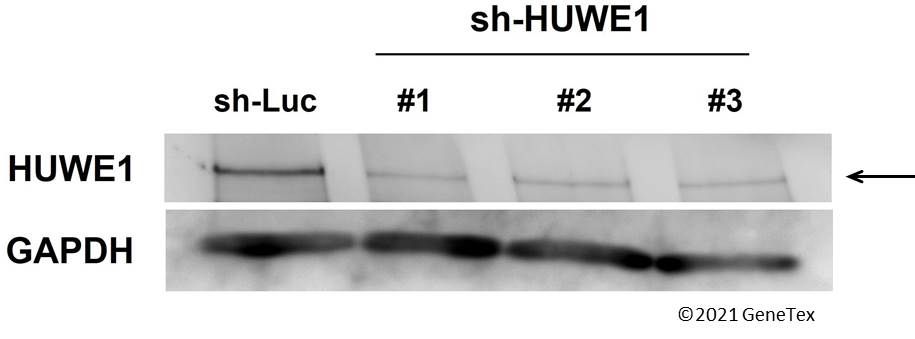 HUWE1抗体 (GTX85051) | GeneTex中文官方网站