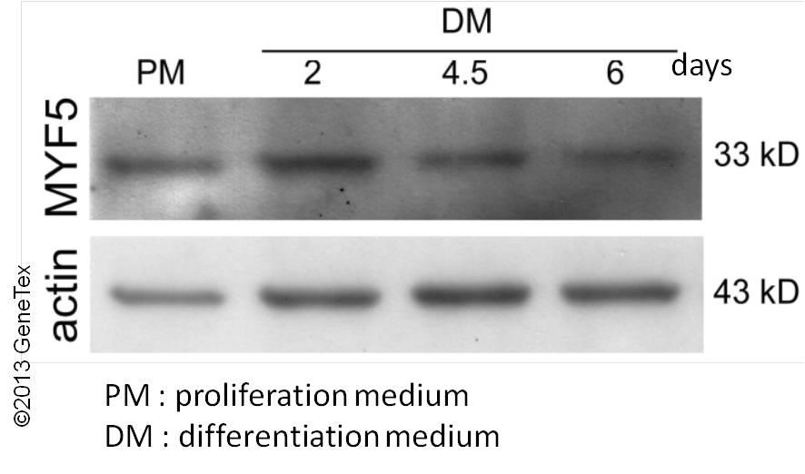 MYF5抗体 (GTX87110) | GeneTex中国官方网站