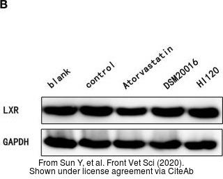 LXR alpha / LXR beta抗体, Internal (GTX89656) | GeneTex中国官方网站