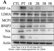 LDHA抗体 (GTX101416) | GeneTex中国官方网站