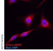 LAMP2抗体 (GTX103214) | GeneTex中国官方网站