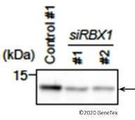 RBX1抗体 (GTX110507) | GeneTex中文官方网站