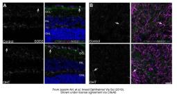 RBPMS抗体 (GTX118619) | GeneTex中国官方网站