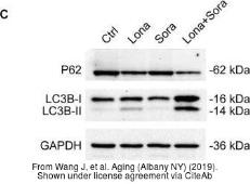 LC3B抗体 (GTX127375) | GeneTex中国官方网站