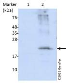 Dengue virus prM protein抗体 (GTX128093) | GeneTex中国官方网站