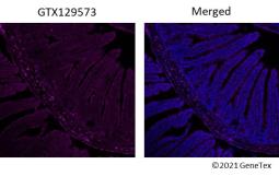 S100 beta抗体 (GTX129573) | GeneTex中国官方网站
