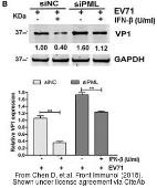 Enterovirus 71 VP1抗体 (GTX132338) | GeneTex中国官方网站