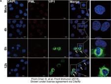 Enterovirus 71 VP1抗体 (GTX132338) | GeneTex中国官方网站