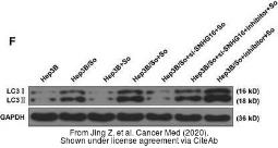 LC3A抗体 [166AT1234] (GTX17380) | GeneTex中国官方网站
