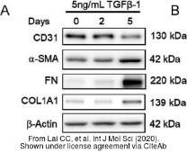 Collagen I抗体 [COL-1] (GTX26308) | GeneTex中国官方网站
