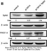 SPHK1抗体 (GTX33516) | GeneTex中国官方网站