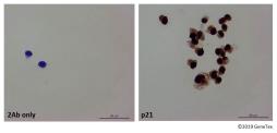 p21 Cip1抗体 [GT1032] (GTX629543) | GeneTex中文官方网站